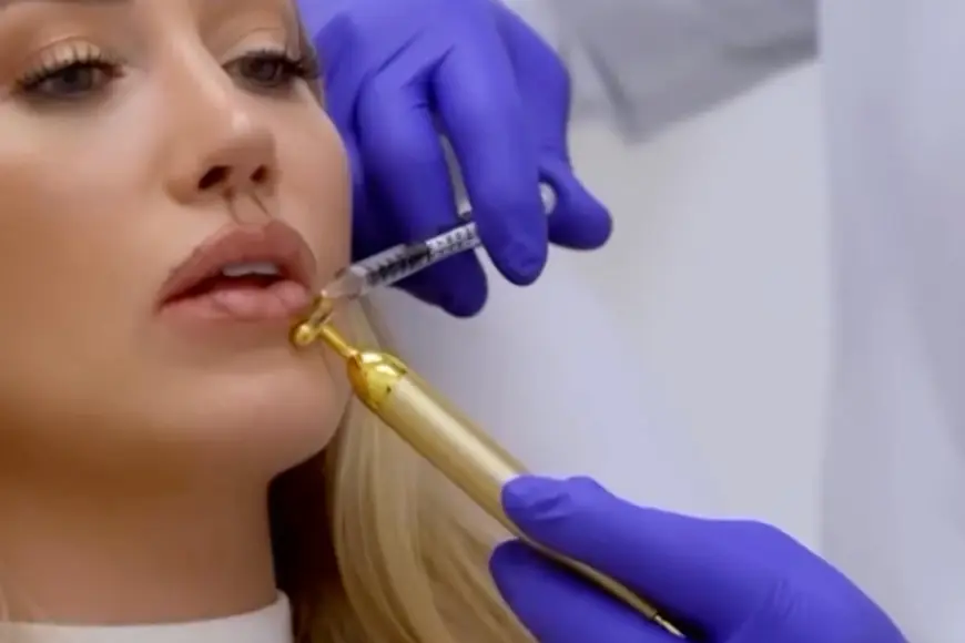 Transformative Lip Enhancements: The Non-Surgical Approach by Dr. Simon ...