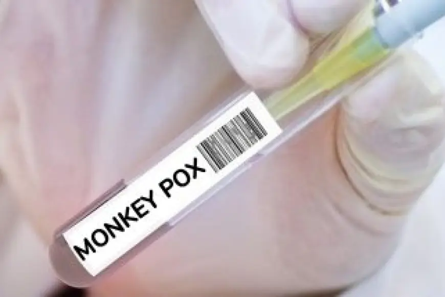Another case of monkeypox in the country, confirmed in a person who ...